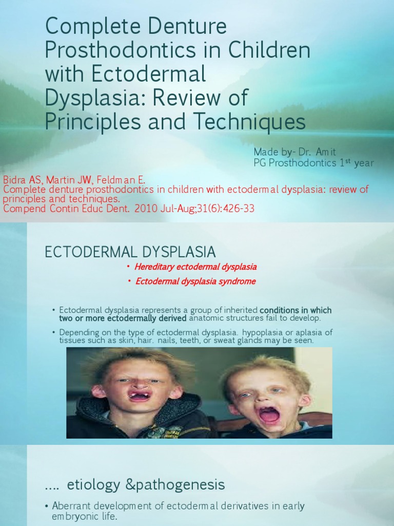 Complete Denture Prosthodontics in Children With Ectodermal Dysplasia | PDF | Dental Implant ...