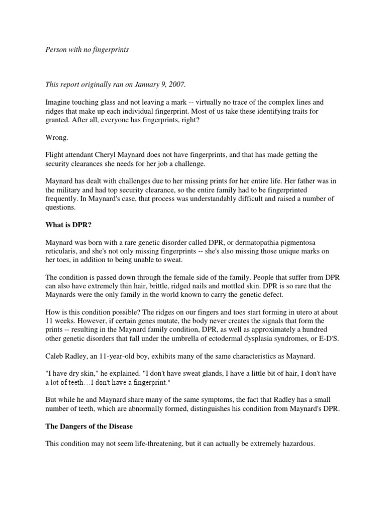 Woman born without fingerprints faces challenges of a rare genetic ...