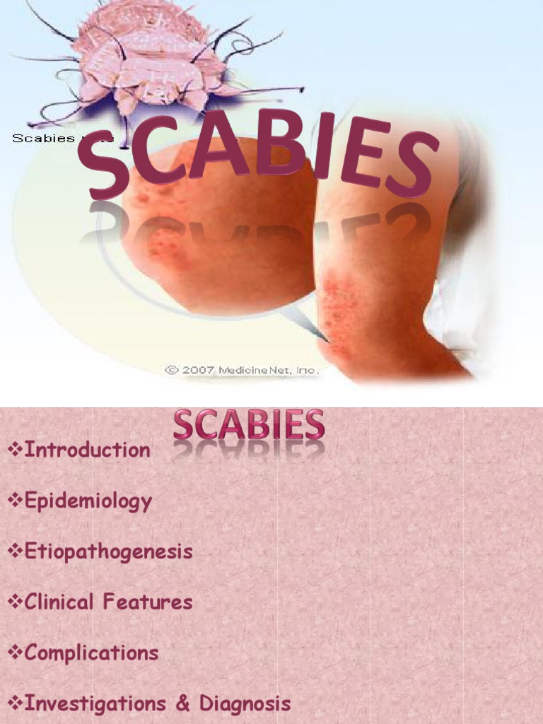 Scabies Riji | Medical Specialties | Diseases And Disorders