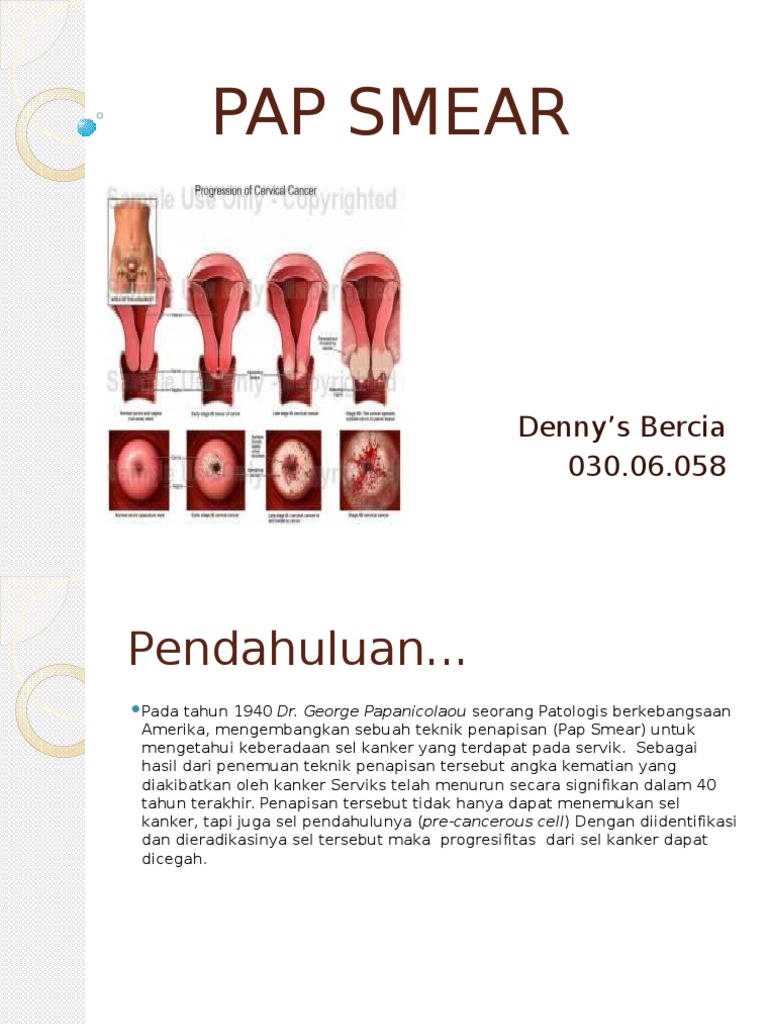 Pap-Smear PPT Final | PDF