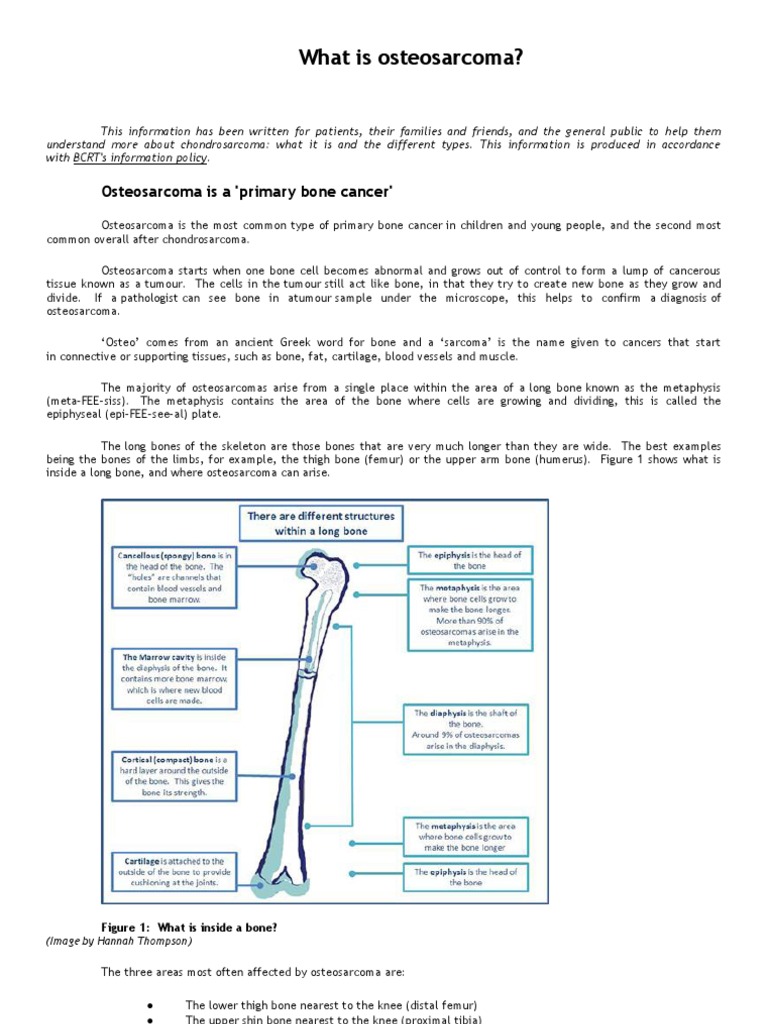 Understanding Osteosarcoma: Key Facts | PDF | Bone | Anatomy