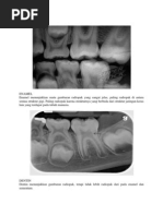 Interpretasi Hasil Foto Rontgen Anatomi Normal | PDF