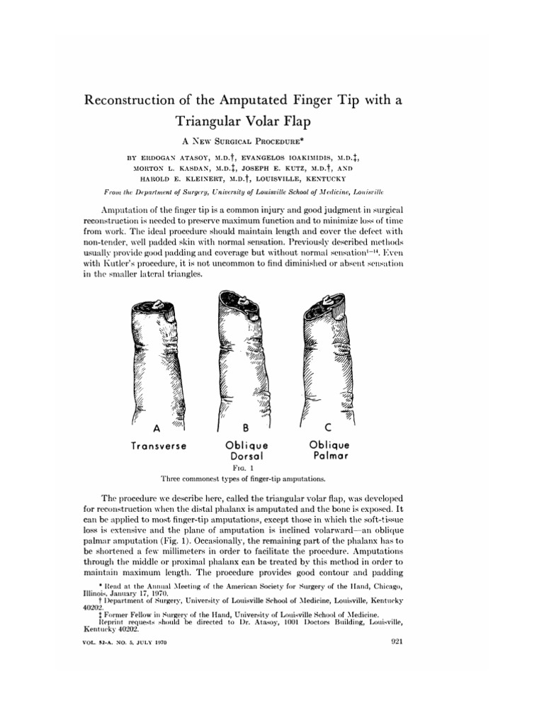 Fingertip Amputation | Finger | Anatomical Terms Of Location