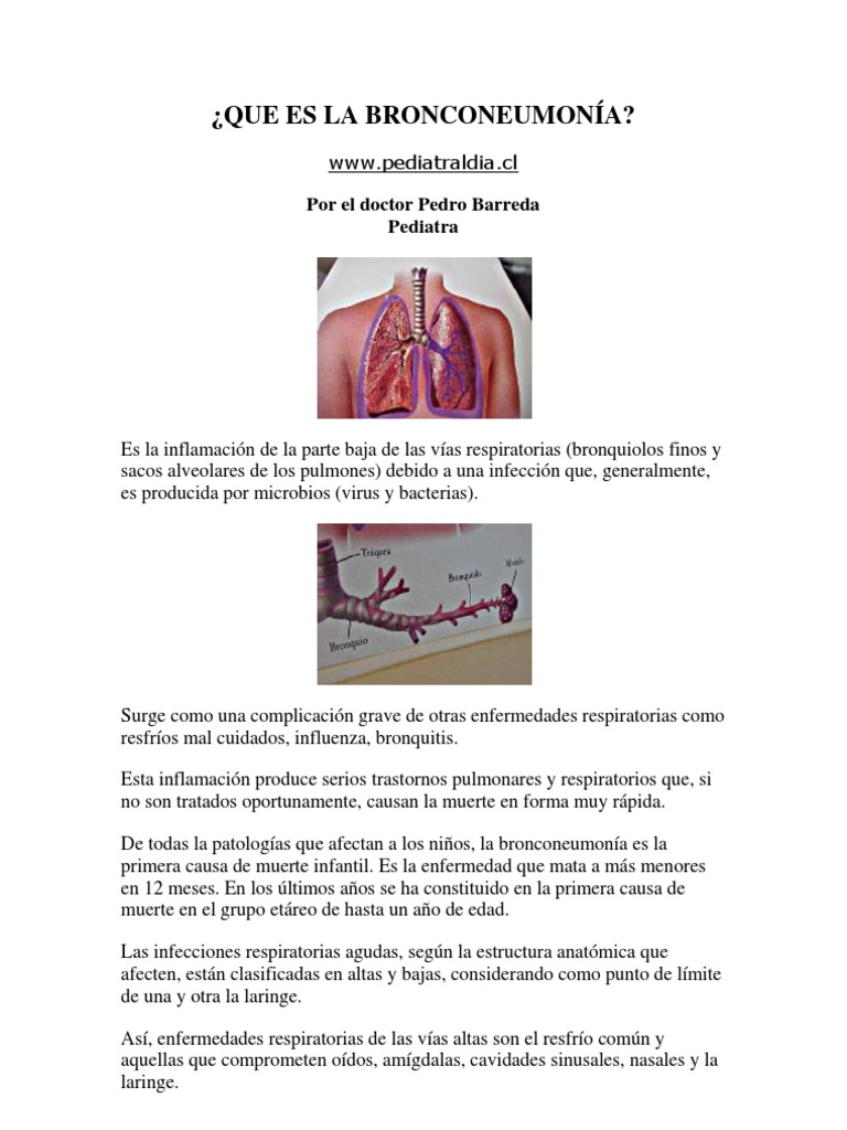 Que Es La Bronconeumonía | PDF | Resfriado comun | Influenza