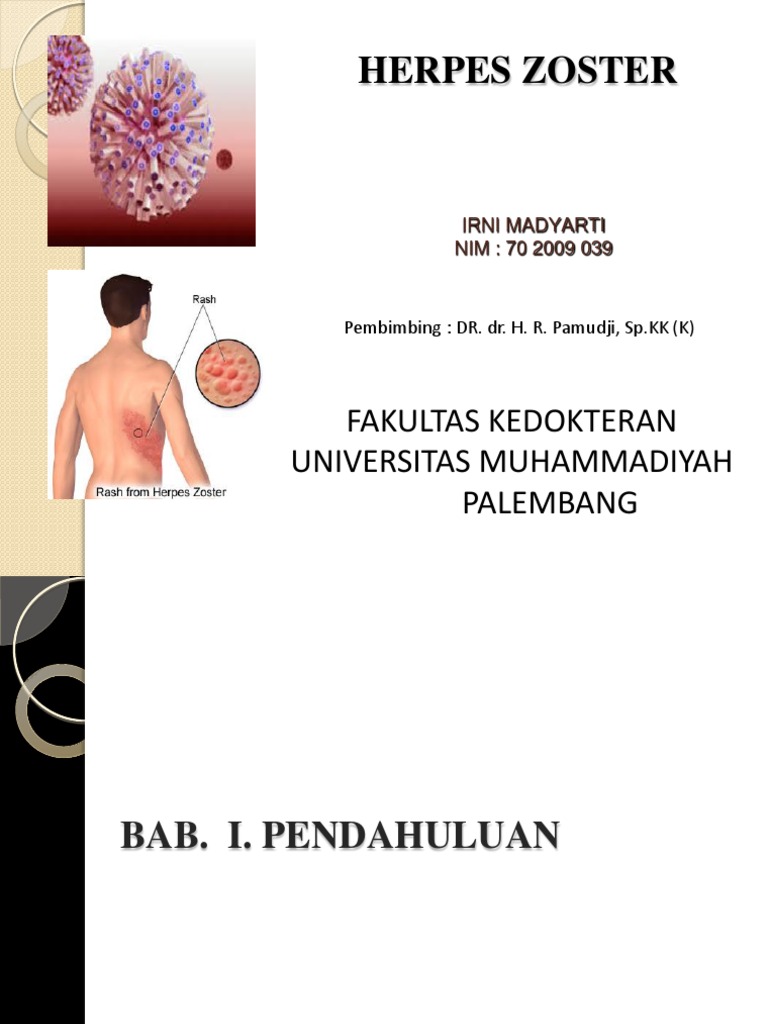 HERPES ZOSTER DIAGNOSIS CHALLENGES | PDF