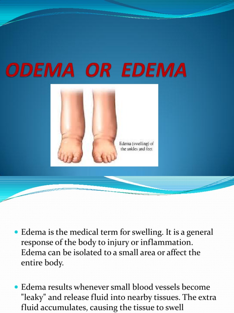 Odema or Edema | Edema | Health Sciences