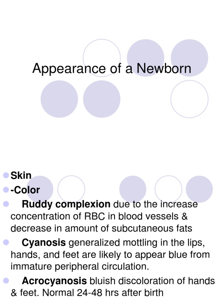 Appearance of A Newborn | PDF | Infants | Blood