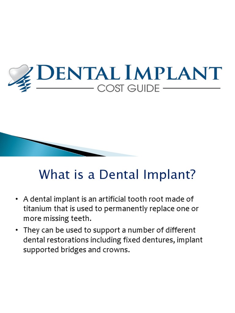 Guide To Dental Implants Cost And Procedure Pdf Dental Implant