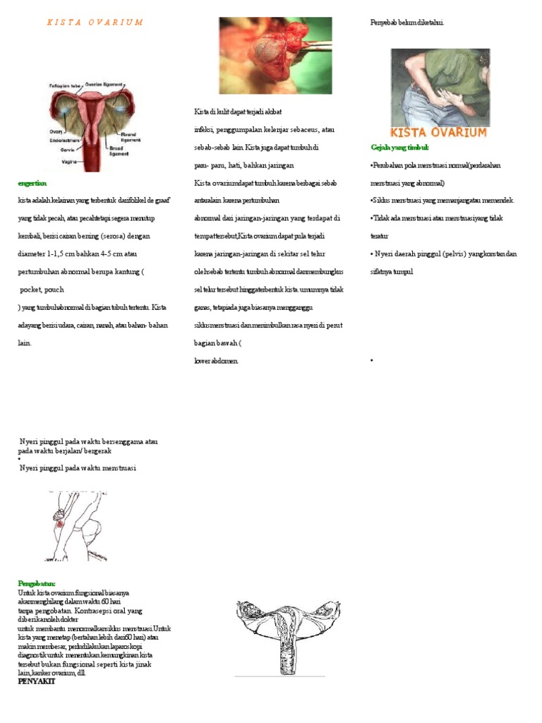Leaflet Kista Ovarium | PDF | Sains & Matematika | Gaya Hidup