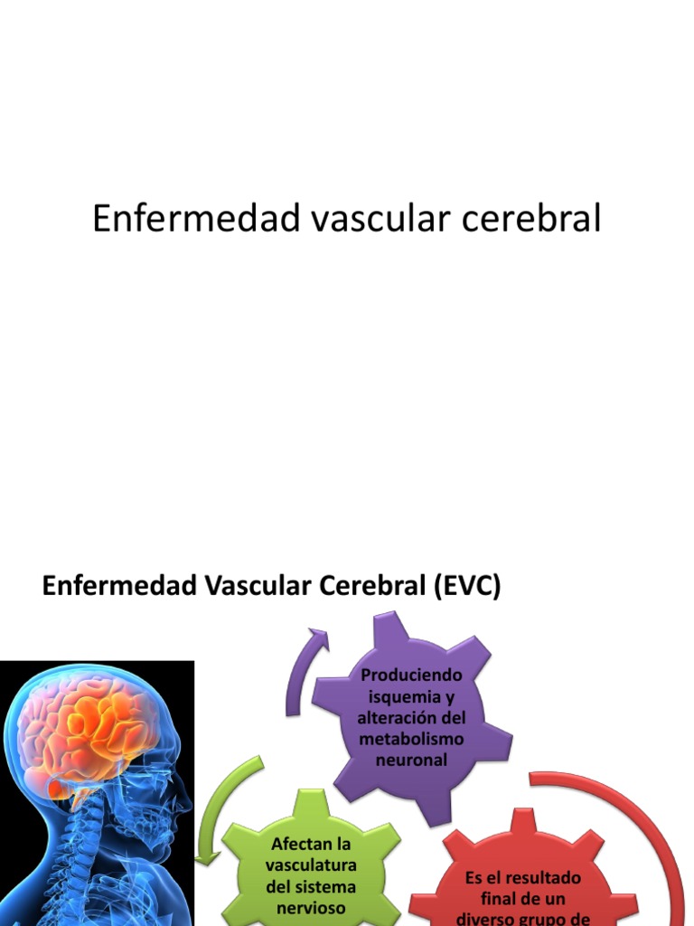 Enfermedad Vascular Cerebral | PDF | Carrera | Isquemia