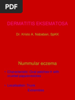 Hanifin and Rajka Criteria | PDF