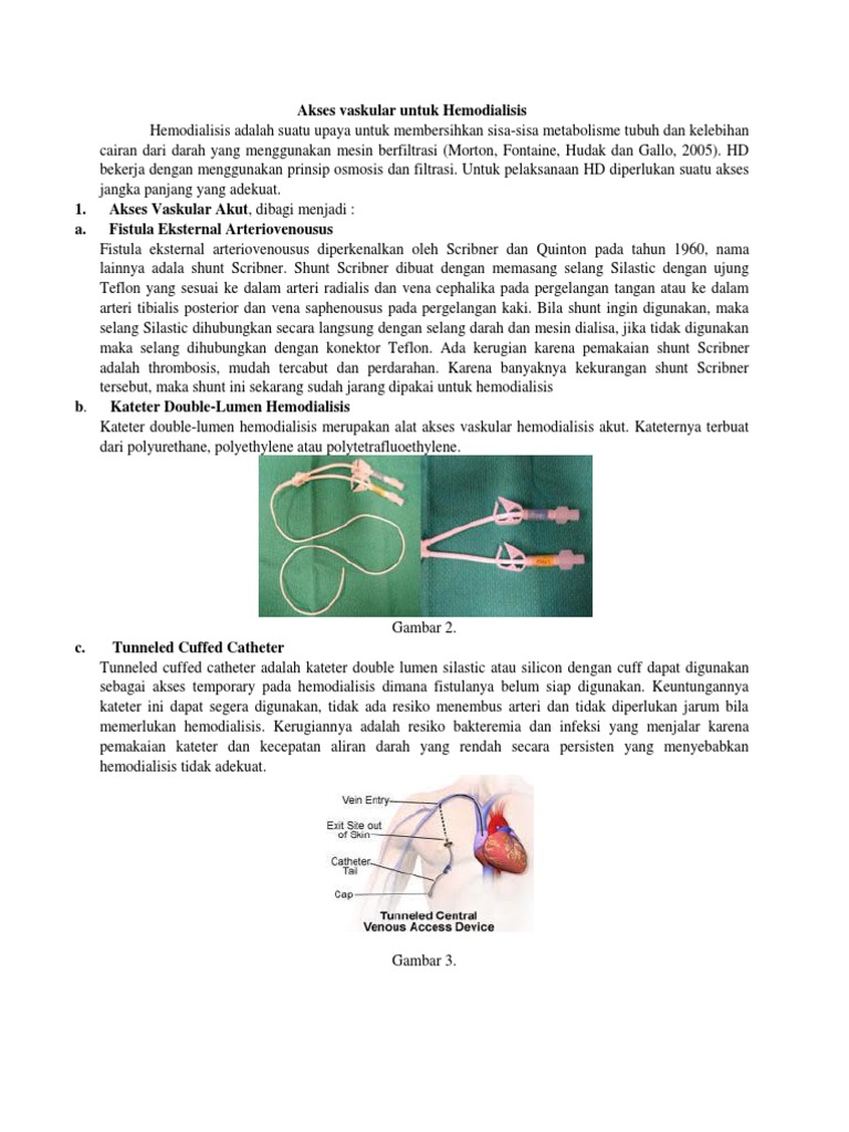 Akses Vaskular Untuk Hemodialisis | PDF