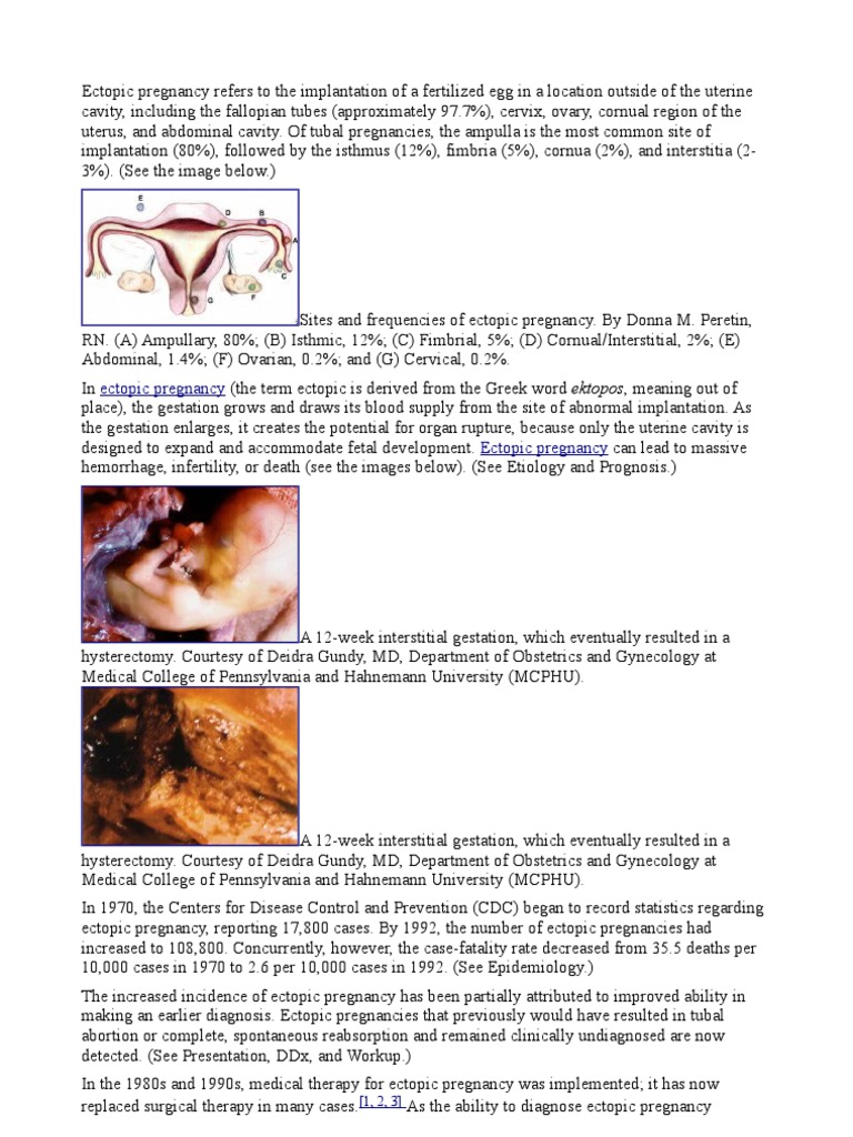 Ectopicw | PDF | Birth Control | Pregnancy