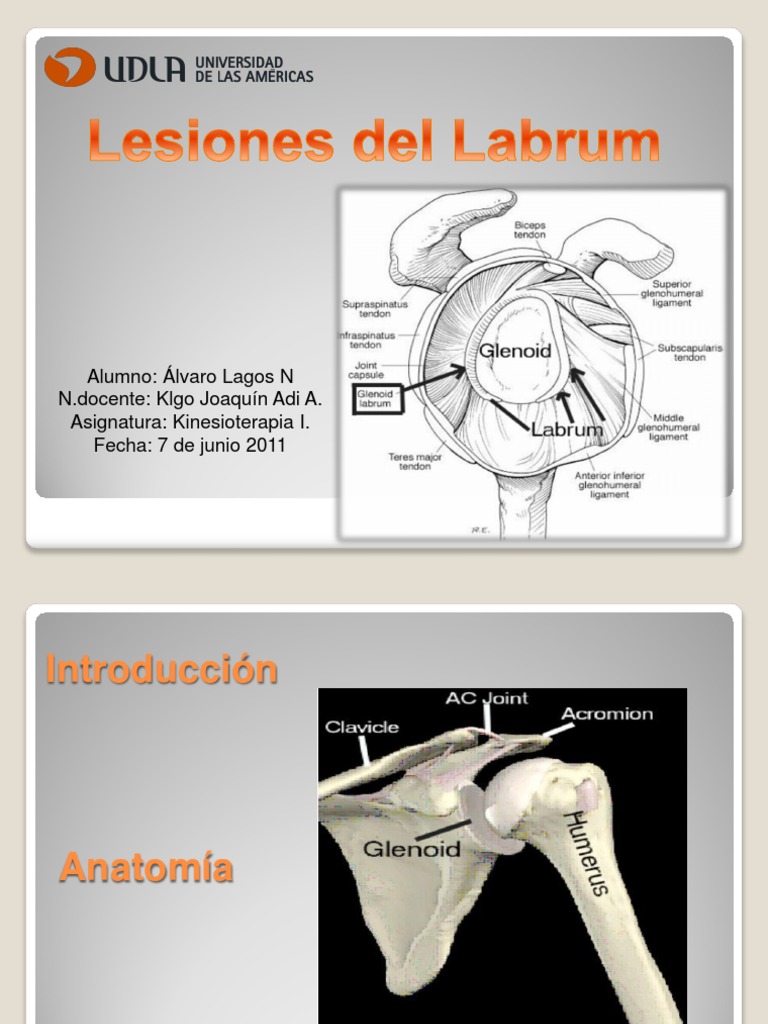 Lesiones Del Labrum | Hombro | Rodilla | Prueba gratuita de 30 días ...