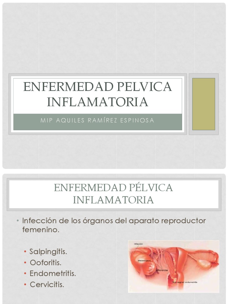 Enfermedad Pelvica Inflamatoria | PDF | Rtt | La salud de la mujer