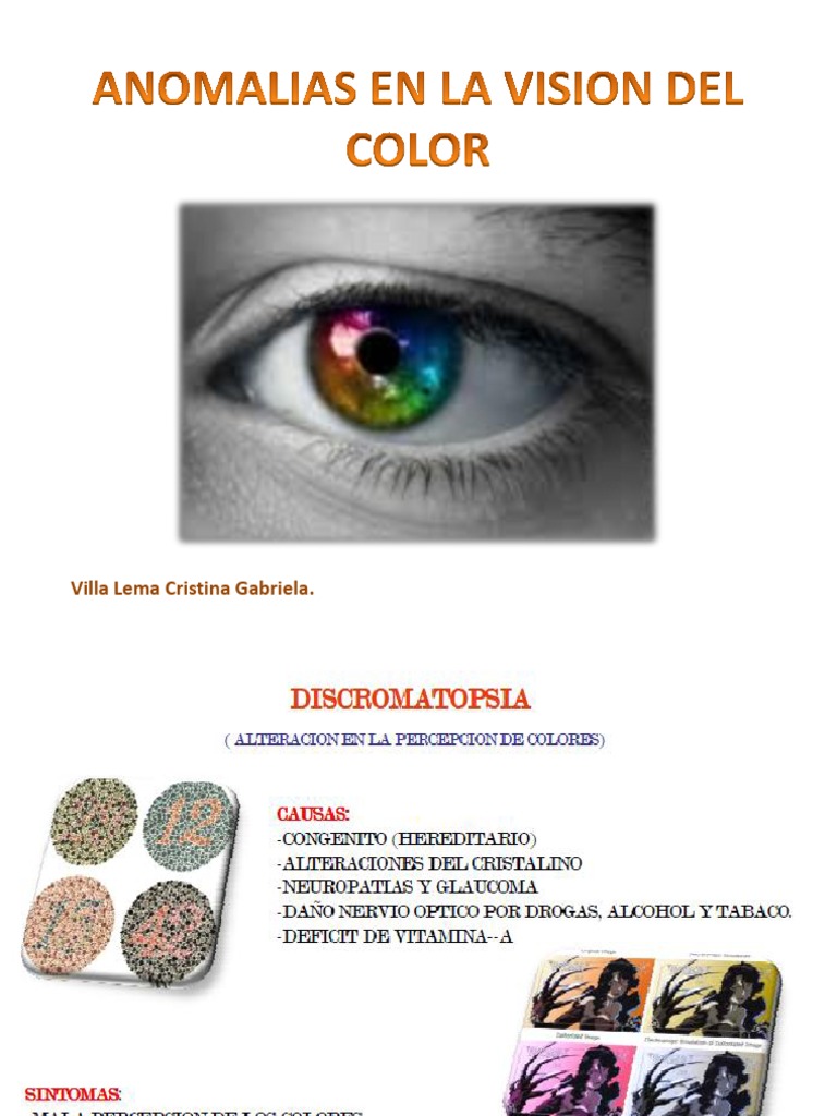 Tipos y diagnóstico de discromatopsia | PDF | Visión | Color