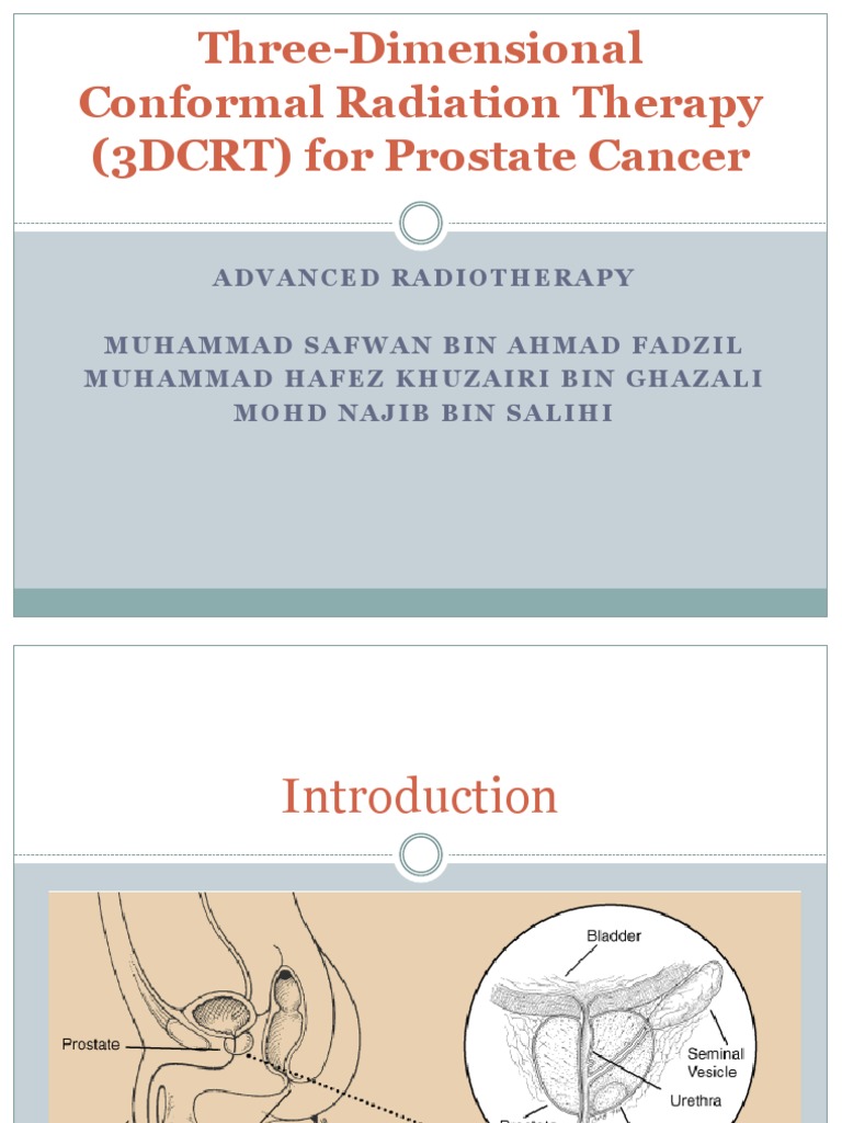 Three-Dimensional Conformal Radiation Therapy (3DCRT) For Prostate ...