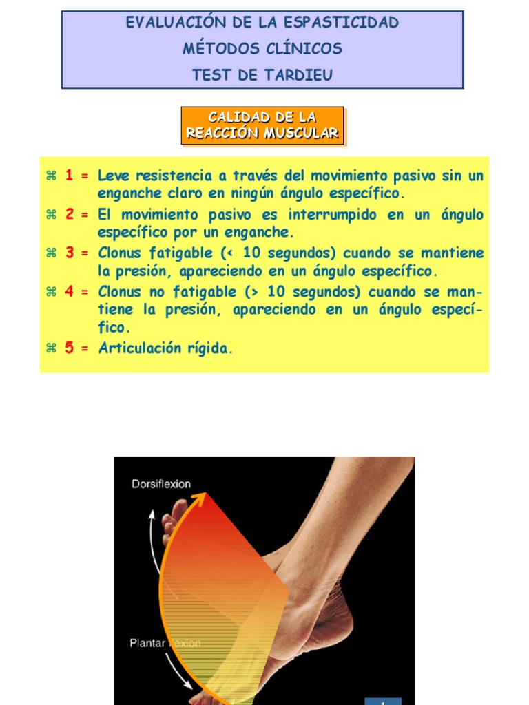 Metodo Clinico Test de Tardieu Espasticidad | PDF