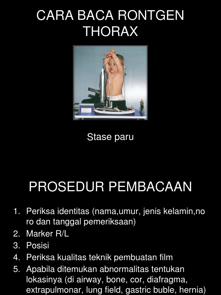Cara Baca Rontgen Thorax Stase Paru | PDF