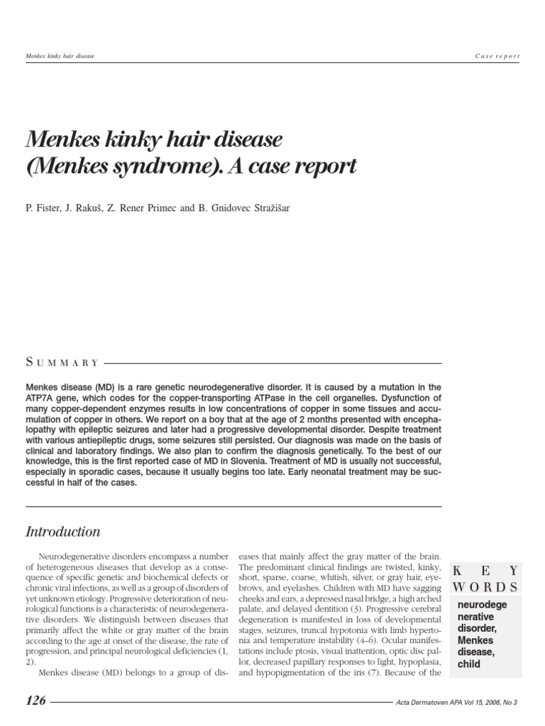 Menkes Kinky Hair Disease (Menkes Syndrome) - A Case Report | PDF ...
