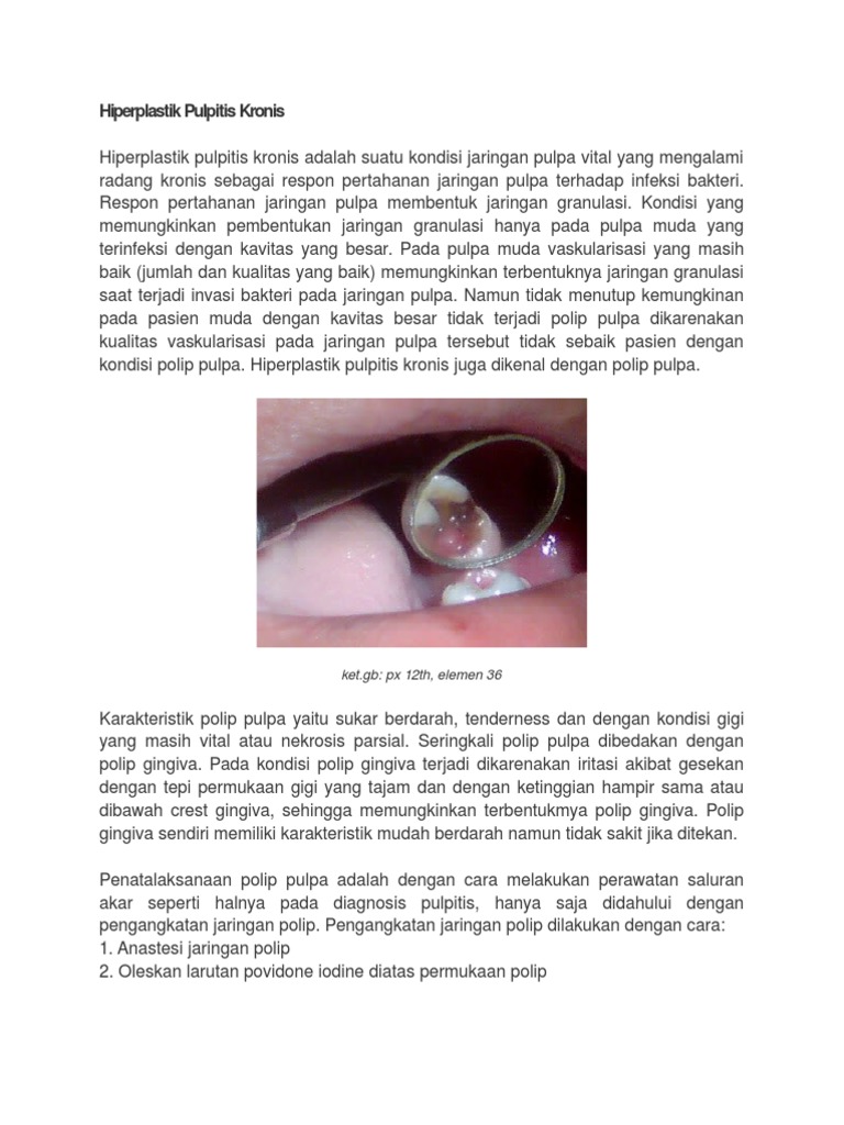 Hiperplastik Pulpitis Kronis | PDF