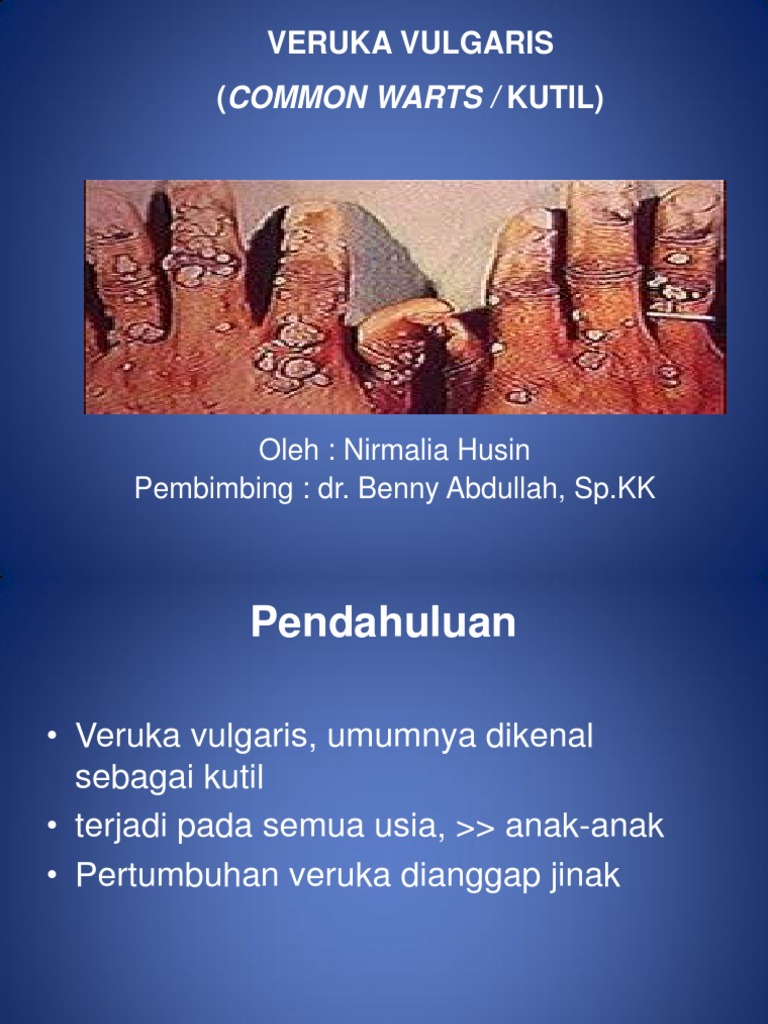 Veruka Vulgaris Lia | PDF | Pengembangan Diri | Sains & Matematika