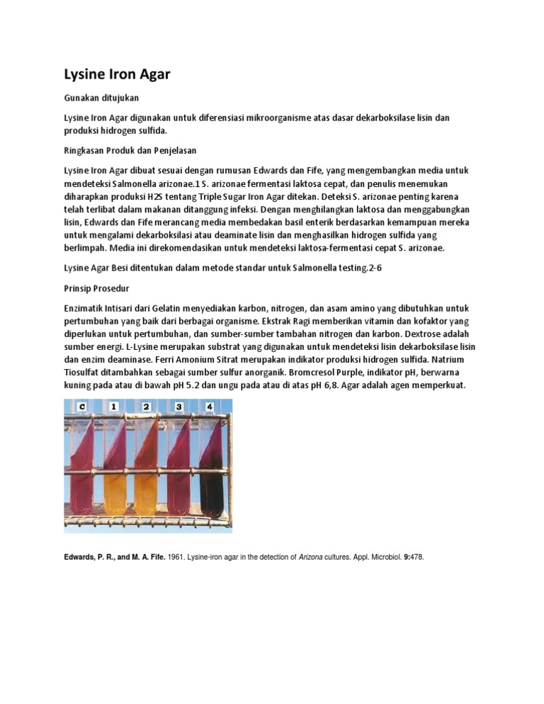 Lysine Iron Agar Test Results Triple Sugar Iron (TSI) Test
