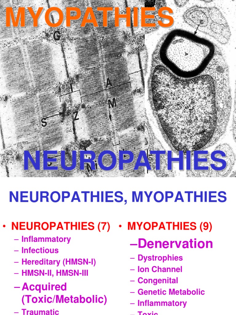 Myopathies: Neuropathies | PDF | Peripheral Neuropathy | Nerve