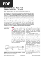 IUD Insertion and Removal Equipment List | PDF | Self-Improvement ...