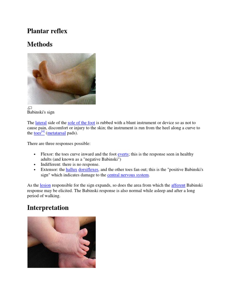 Plantar Reflex | PDF | Anatomy | Nervous System