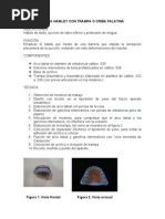 Elaboración de Ganchos Adams en Ortodoncia | PDF | Ortodoncia | Naturaleza