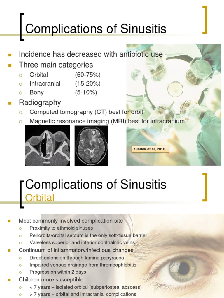 Complication of Sinus Disease | PDF | Thrombosis | Headache