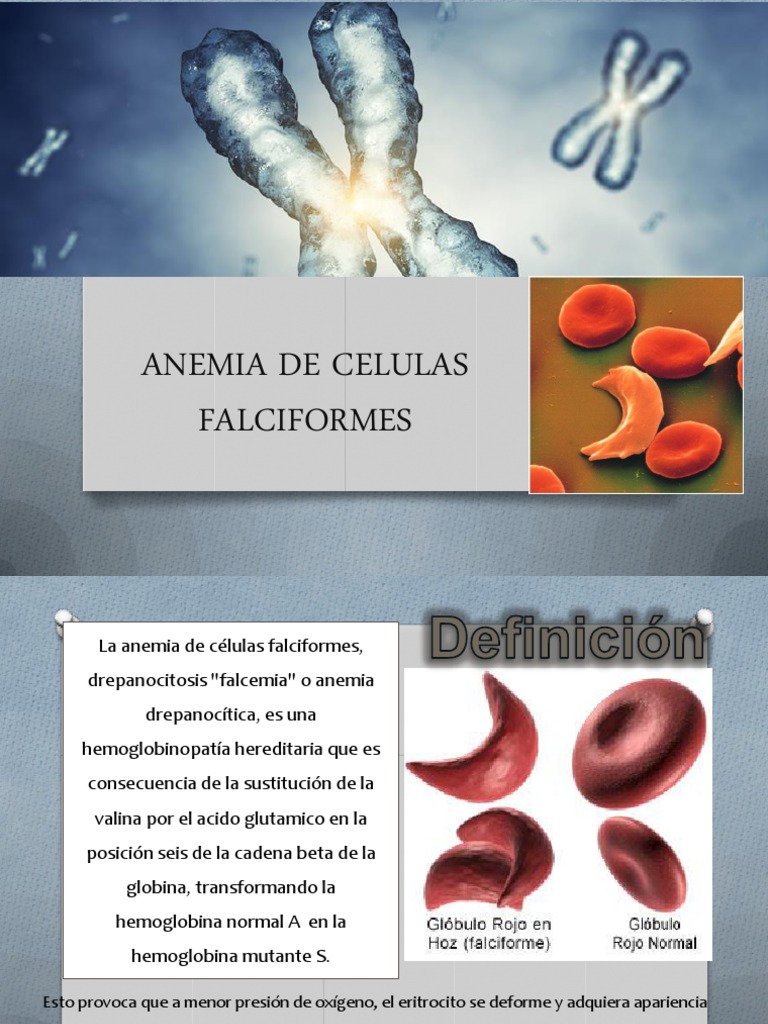 Anemia de Celulas Falciformes | Enfermedad de célula falciforme ...