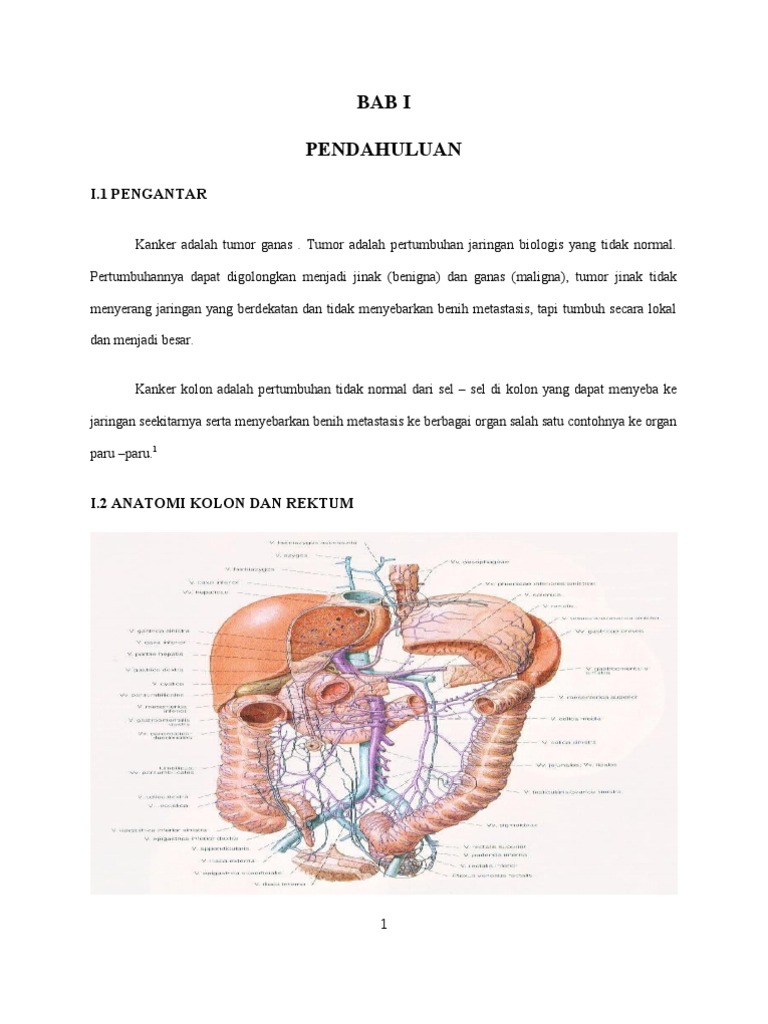 Karsinoma Kolon | PDF