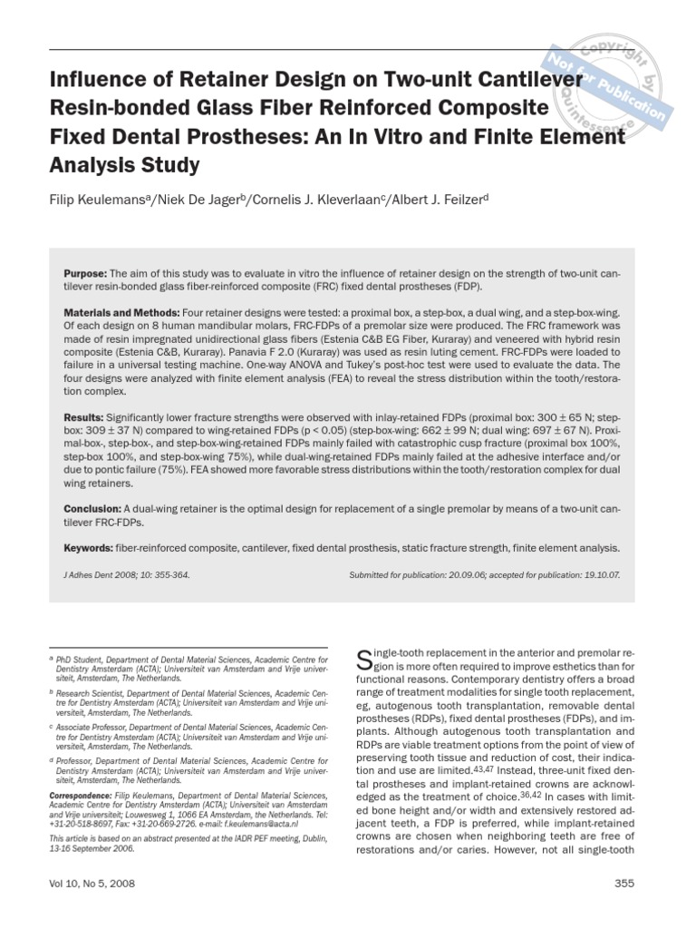 Influence of Retainer Design On Two Unit Cantilever Resin Bonded Glass ...