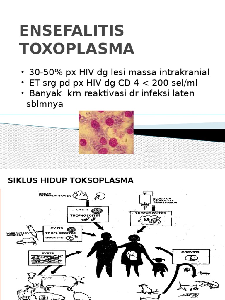 Ensefalitis Toxoplasma | PDF