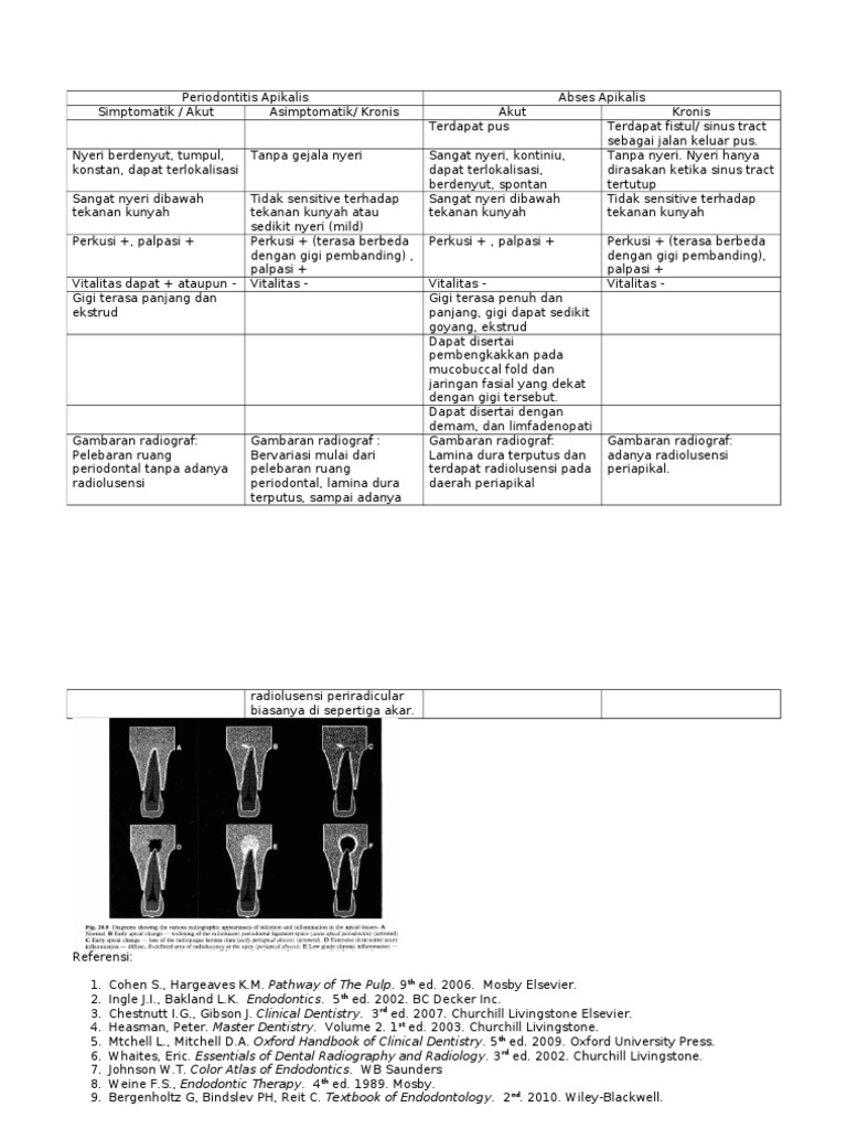 Periodontitis Apikalis Vs Abses Periapikal | PDF