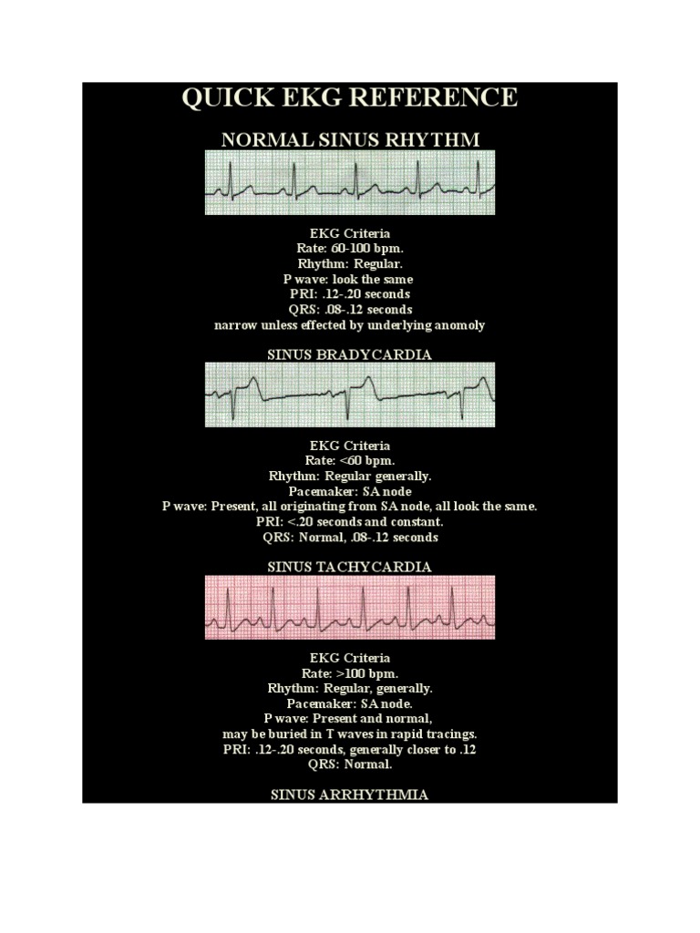 Quick Ekg Reference | PDF | Electrocardiography | Artificial Cardiac ...