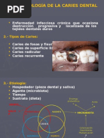 Teorías de Caries y Triada de Keyes | PDF | Las bacterias | Diente