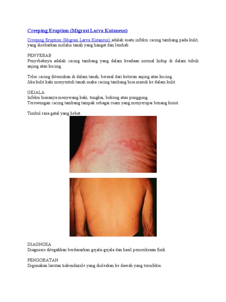 Creeping Eruption | PDF