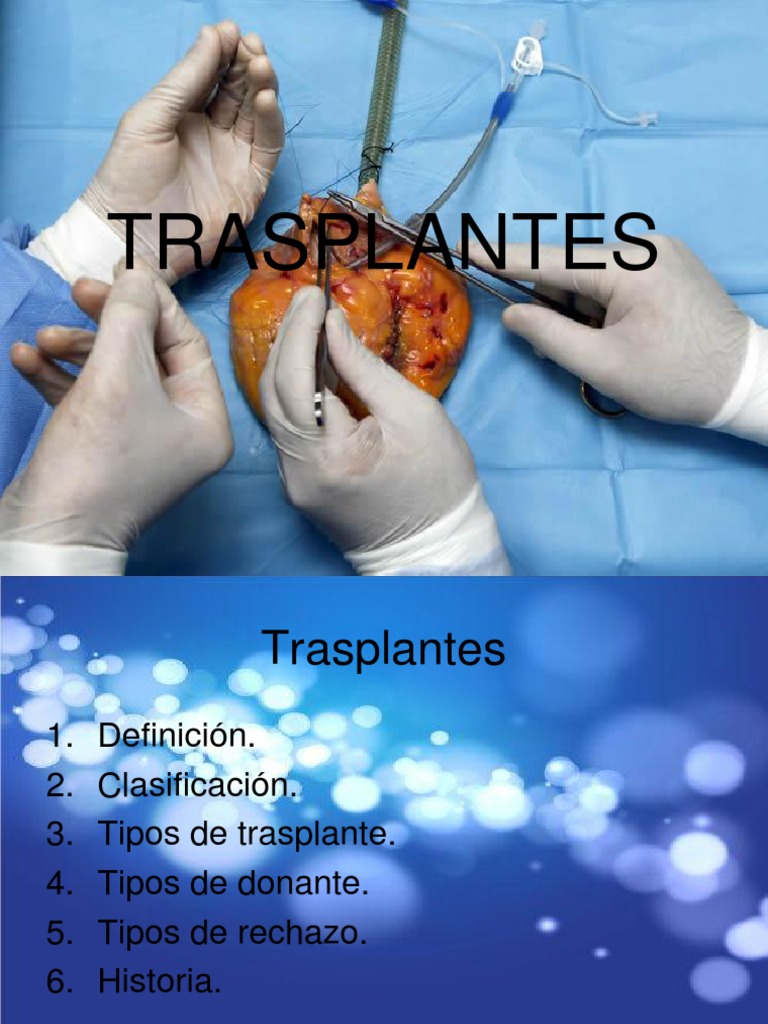 TRASPLANTES Y DONACION DE ORGANOS.ppt | Transplante de organo | Sangre