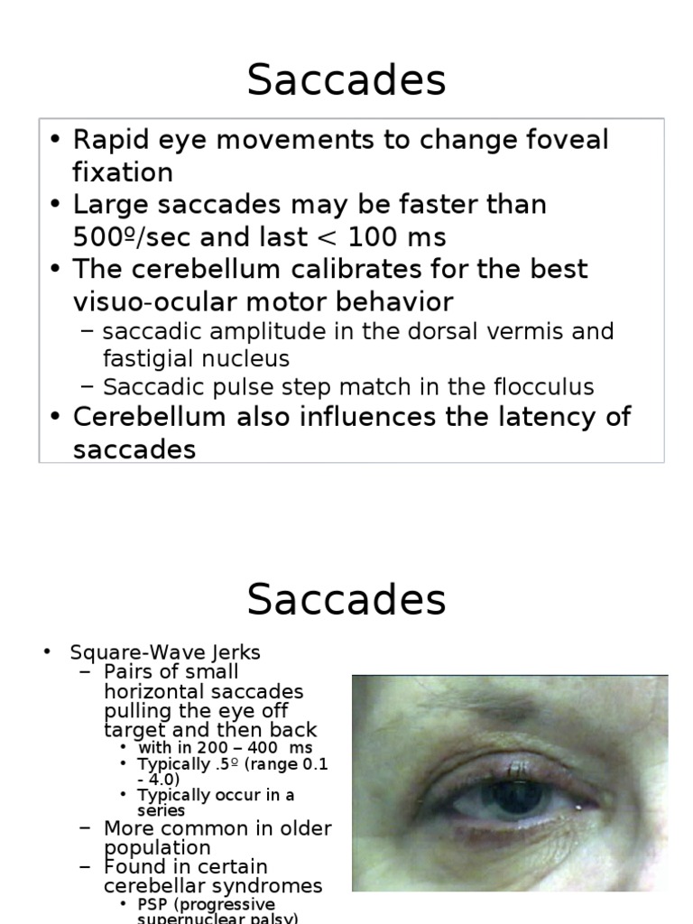 Understanding Saccades and Their Abnormalities | PDF | Cerebellum ...