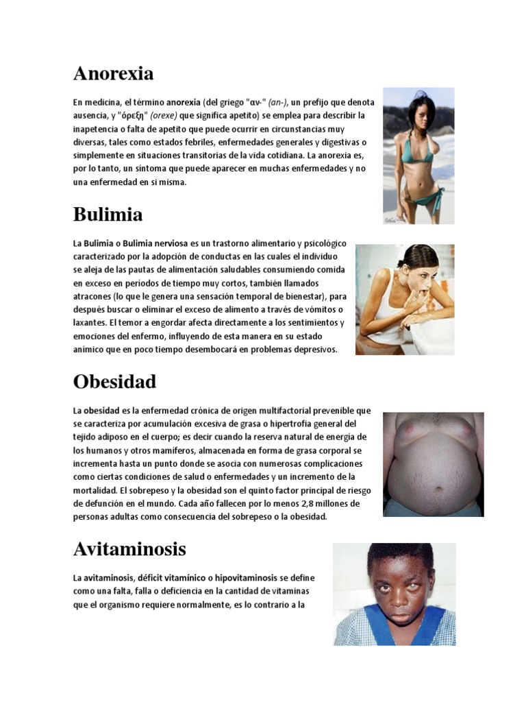 Definición y significado de anorexia | PDF | Bulimia nerviosa | Obesidad
