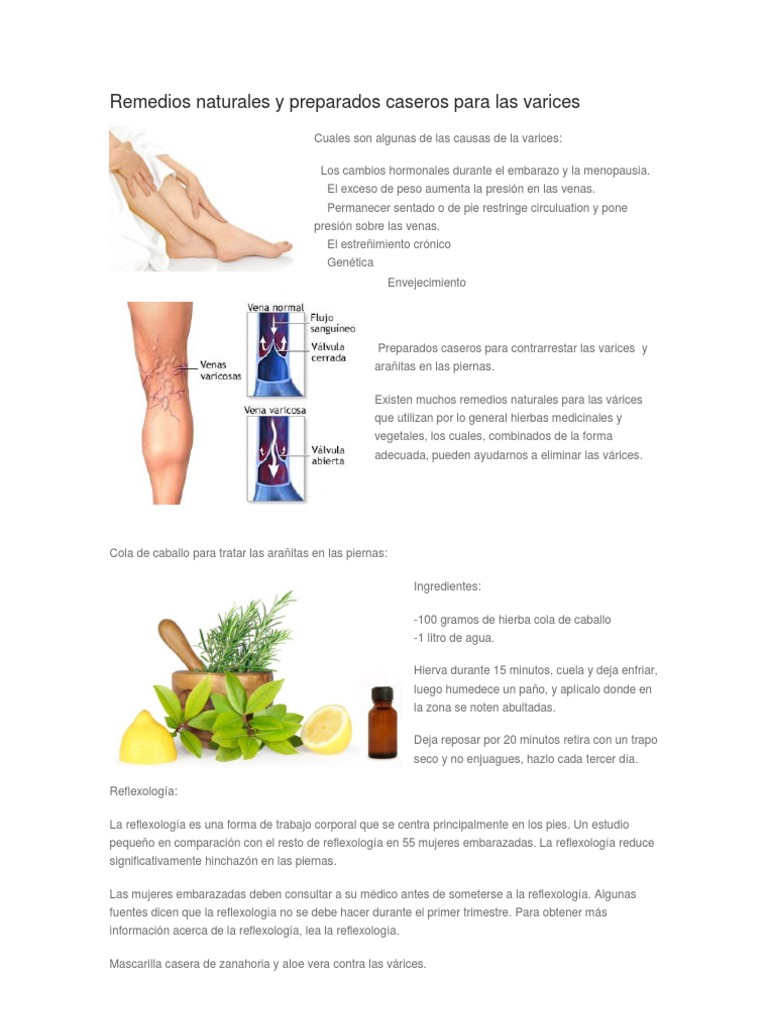 Remedios Naturales y Preparados Caseros para Las Varices | PDF | Salud ...