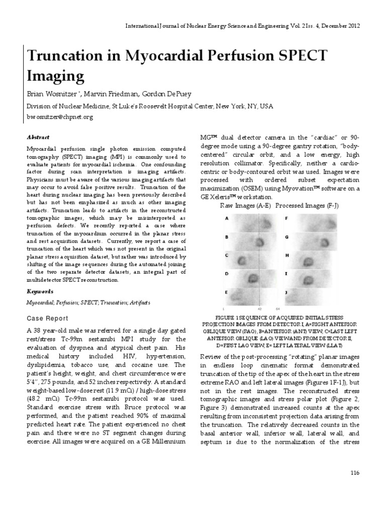 Truncation in Myocardial Perfusion SPECT Imaging | PDF | Medical ...