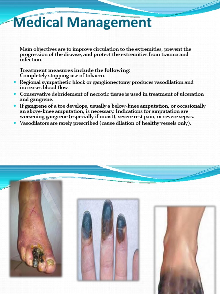 Medical Management of Peripheral Vascular Disease | PDF | Vasodilation ...