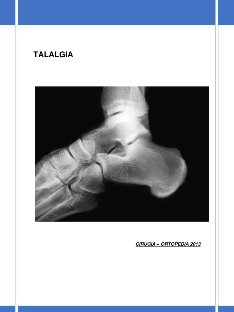 Causas y Diagnóstico de Talalgia | PDF | Pie | Tobillo