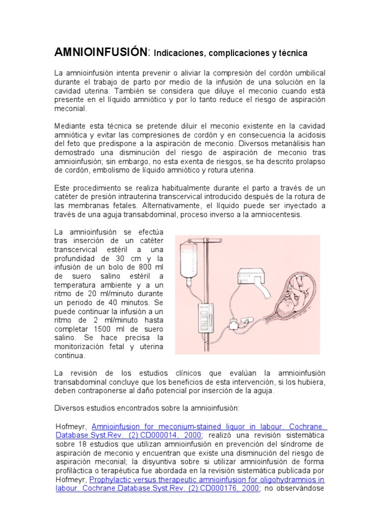 Amnio Infusion | PDF | Parto | Especialidades Medicas