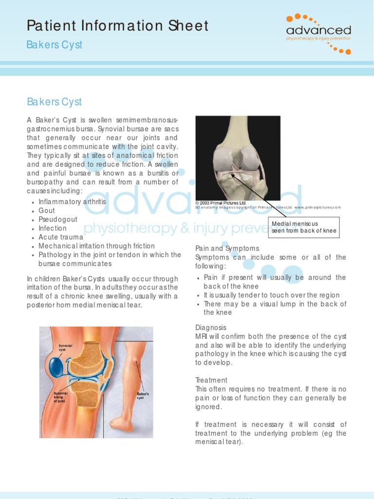 Knee - Bakers Cyst