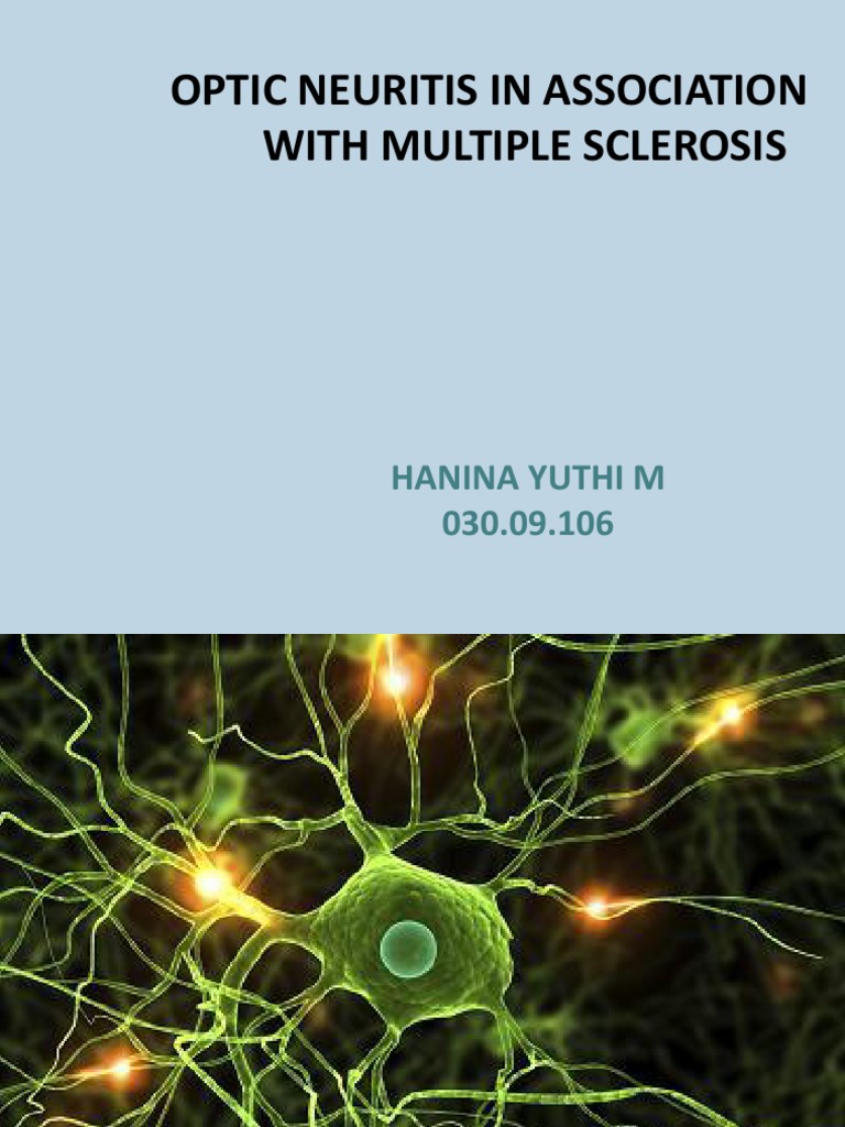 Optic Neuritis in Association With Multiple Sclerosis: Hanina Yuthi M ...
